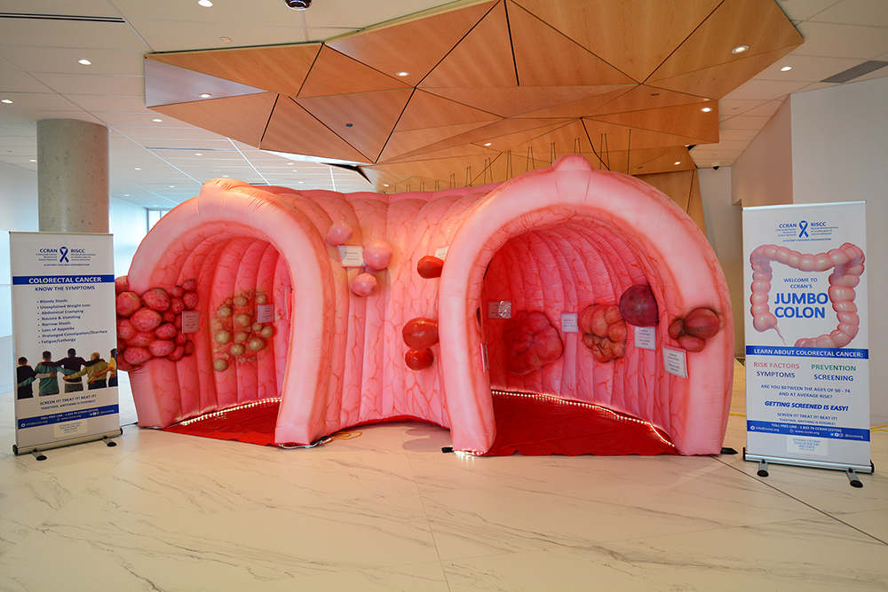 Jumbo Colon Exhibit
